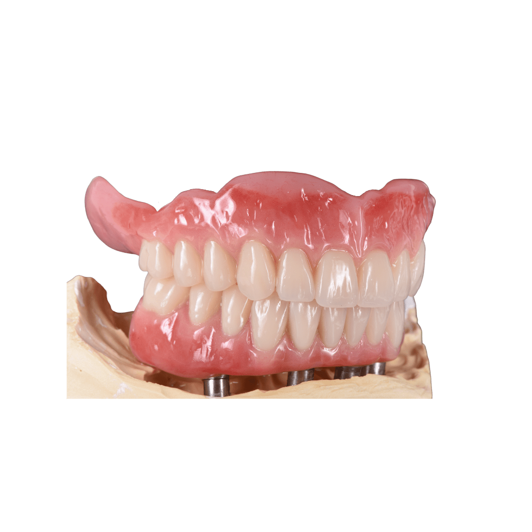 Immediate Loading Acrylic Bridge